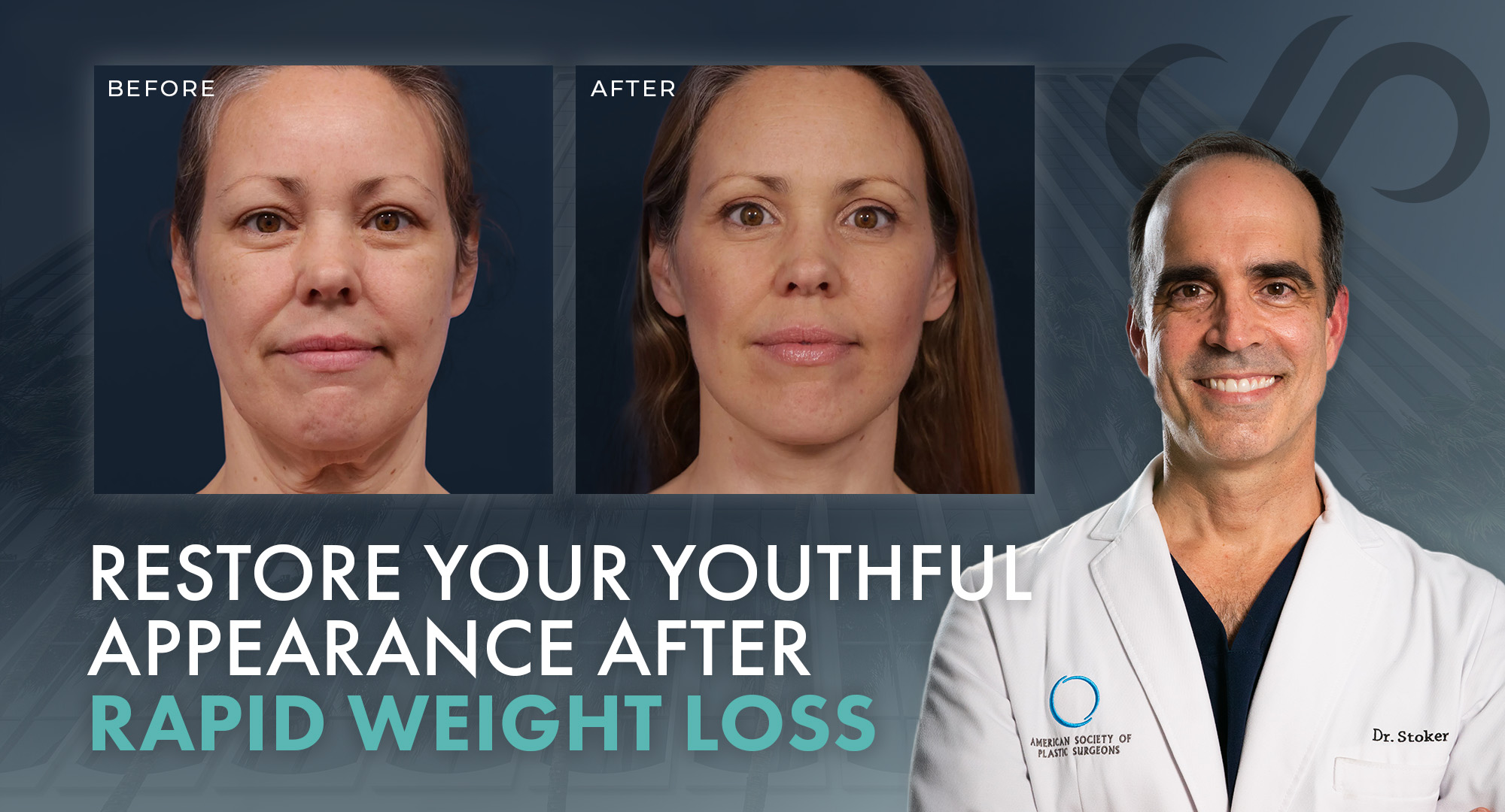 Facelift After Weight Loss: Tackling ‘Ozempic Face’ & Reclaiming Your Confidence – Dr. David Stoker