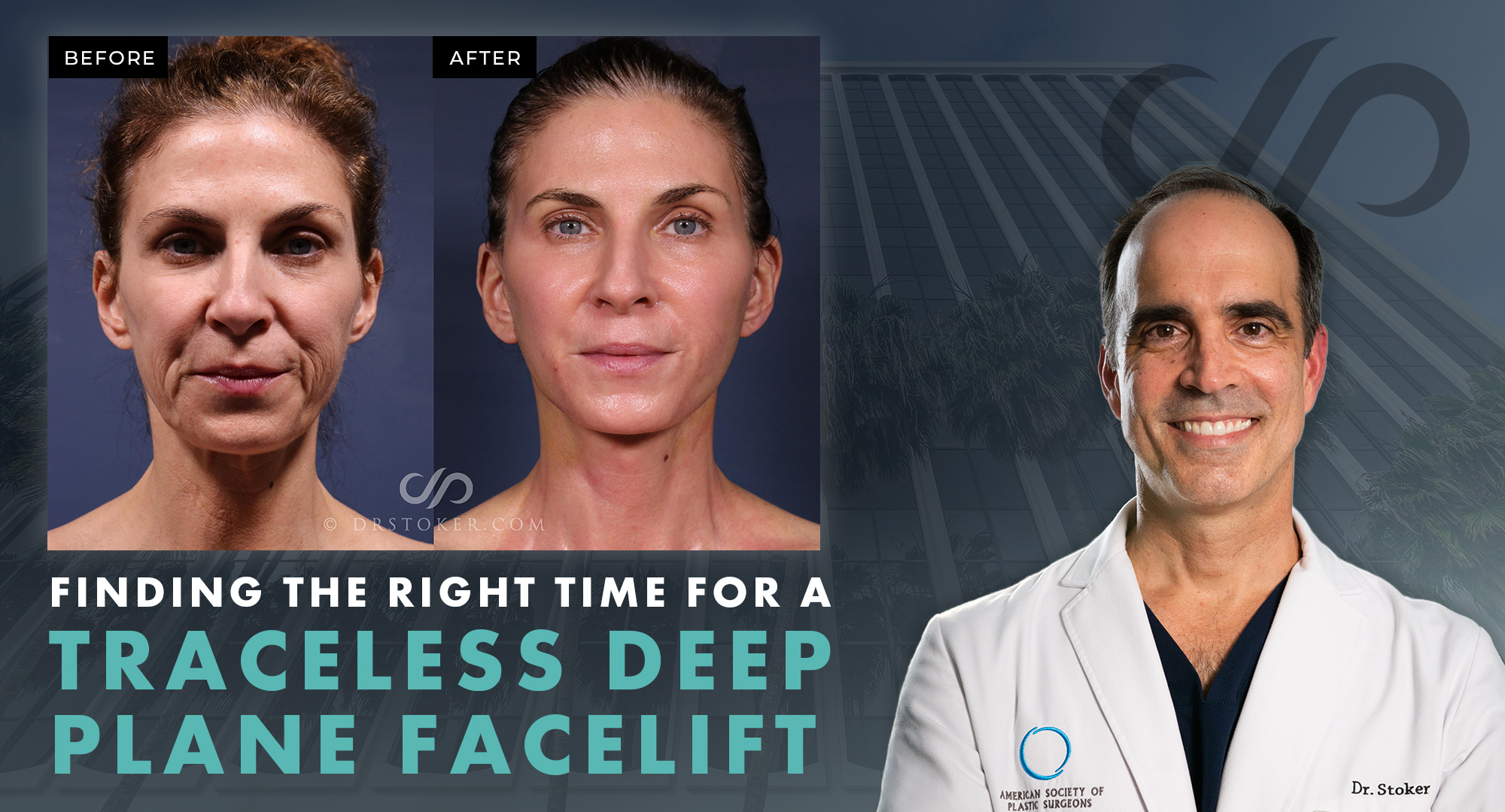 Timing Your Transformation: What Is the Best Age To Get a Traceless ...